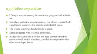 Amputation.pptx