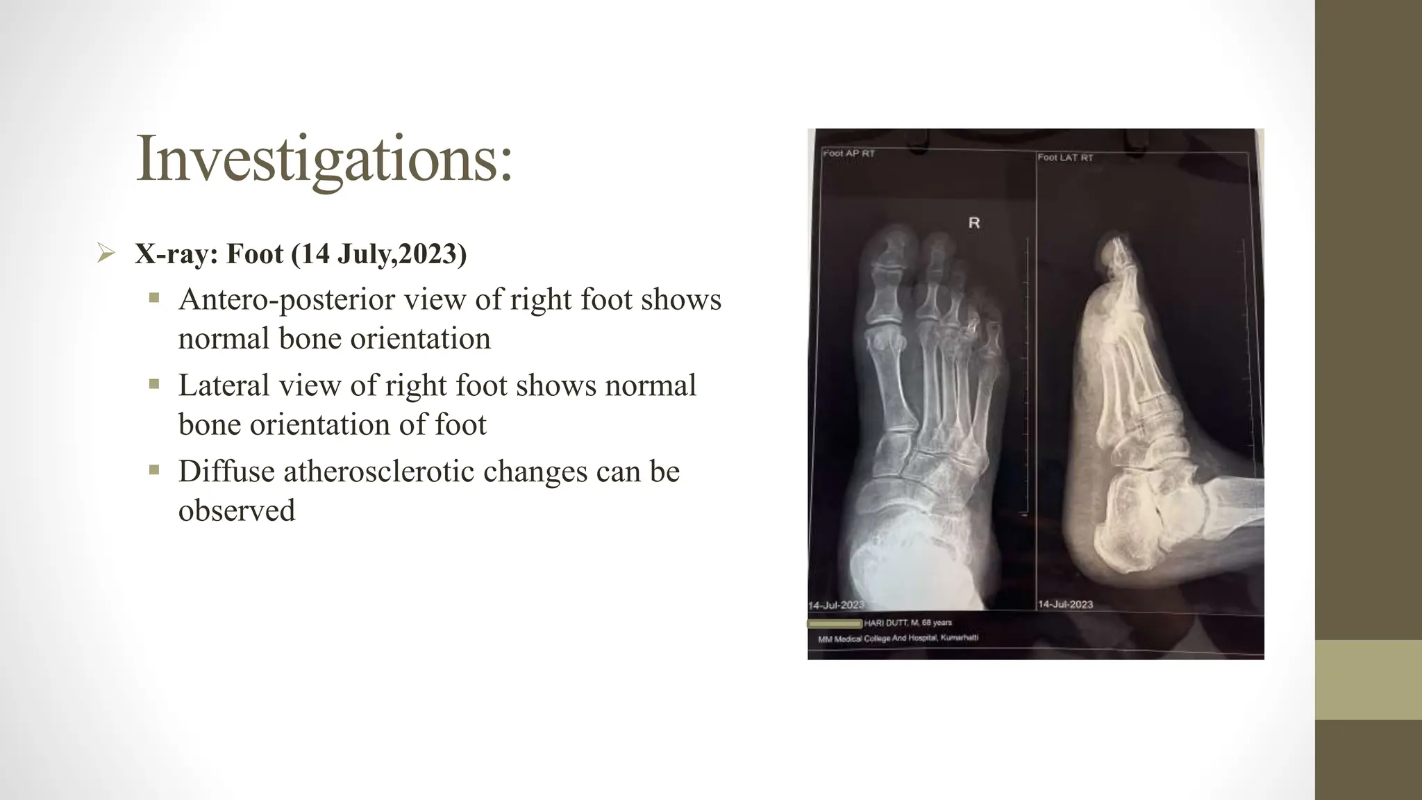 Peripheral Vascular Disease (PVD): Physiotherapy assessment and ...