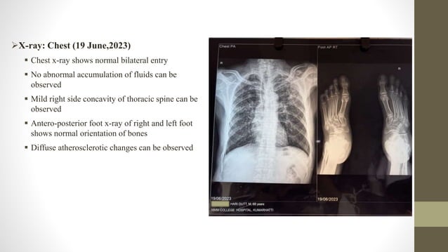 Peripheral Vascular Disease (PVD): Physiotherapy assessment and ...