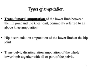 The amputation topic it's discribe all about amputation and procedure ...