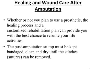 The amputation topic it's discribe all about amputation and procedure ...