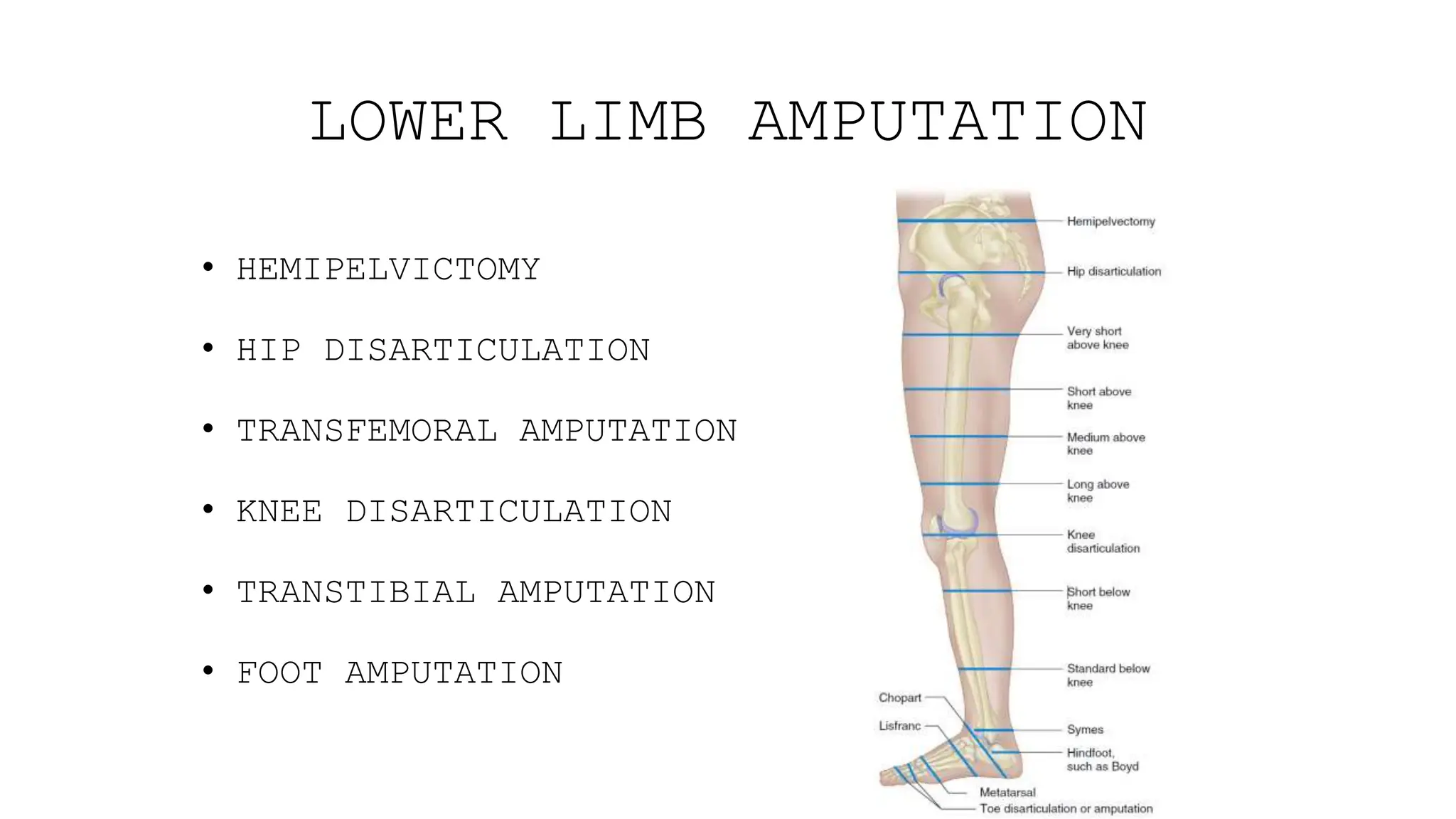 Amputation Topic Orthopaedics Presentation | PPTX