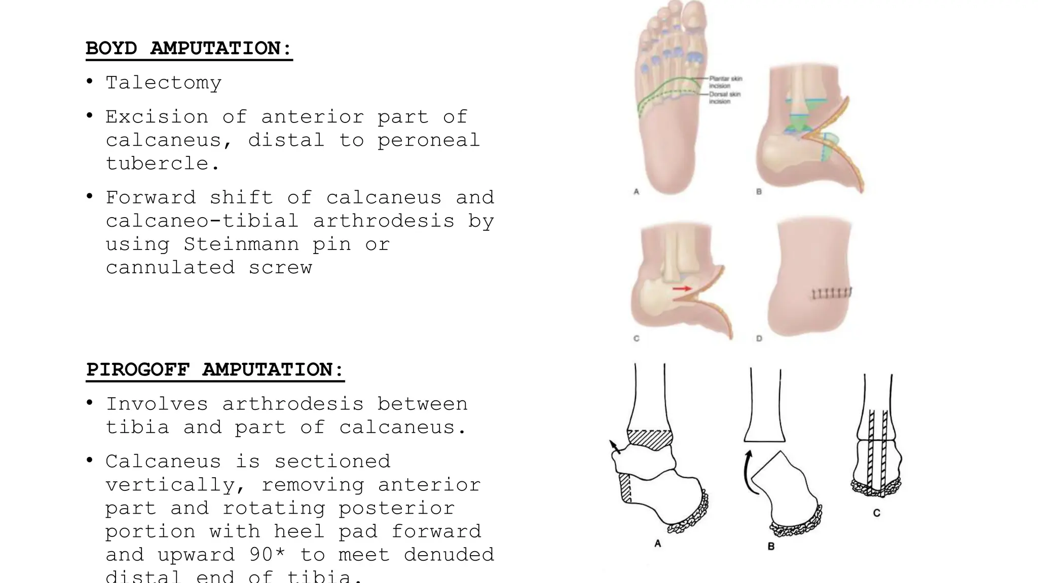 Amputation Topic Orthopaedics Presentation | PPTX
