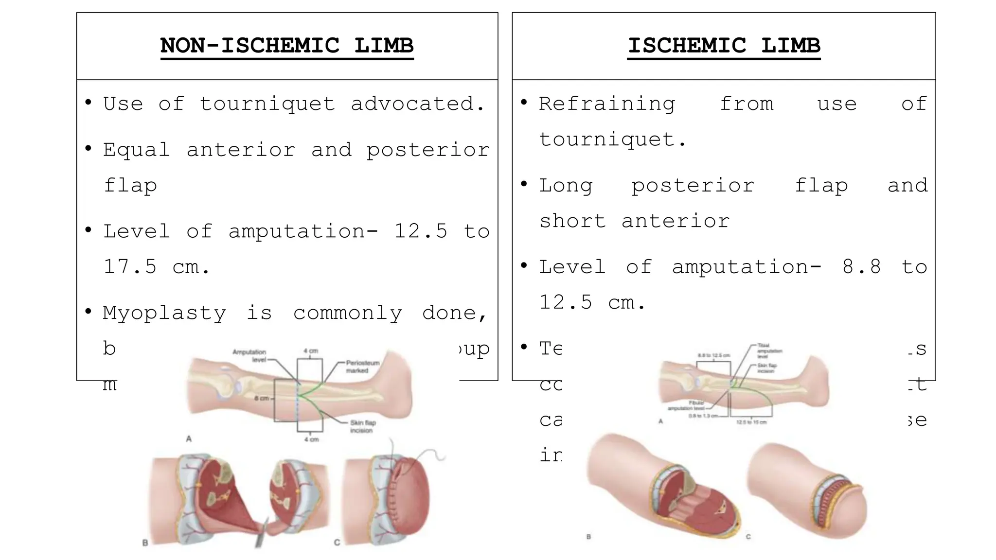 Amputation Topic Orthopaedics Presentation | PPTX