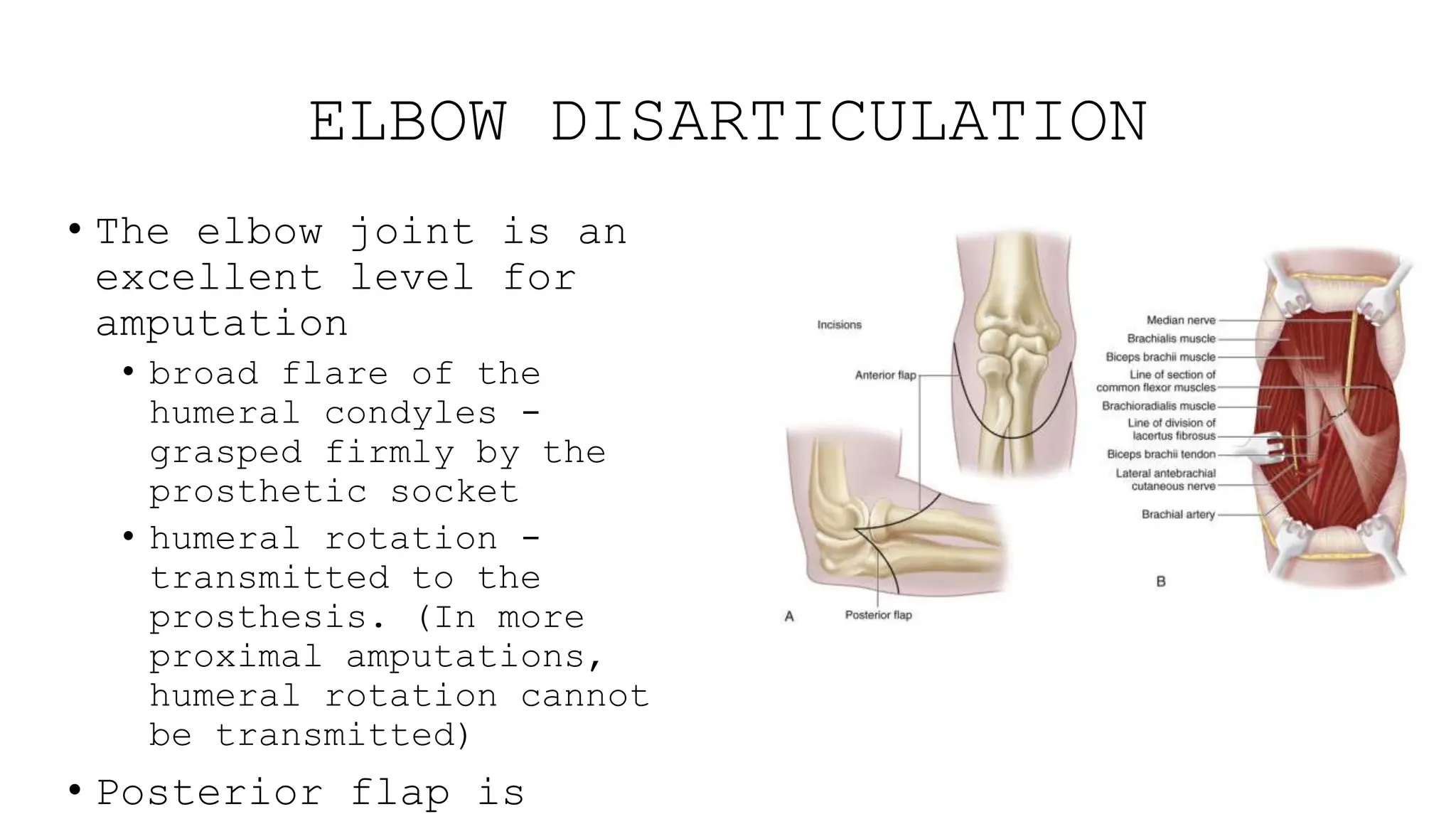 Amputation Topic Orthopaedics Presentation | PPTX
