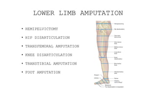 Amputation Topic Orthopaedics Presentation | PPTX