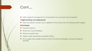 notes on general introduction to AMPUTATION.pptx