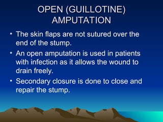 AMPUTATION.ppt by rashid chinthalo st lukes | PPT
