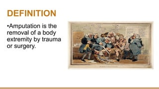 AMPUTATION.pdf,................PT MANAGEMENT | PDF