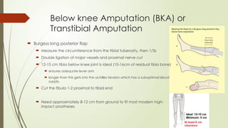 Amputation of the lower limb orthopedics.pptx