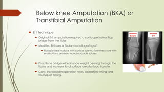 Amputation of the lower limb orthopedics.pptx