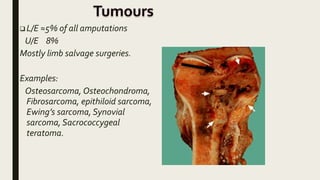 Amputation dr. harsh | PPTX