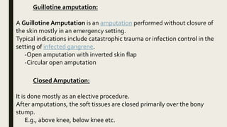 Amputation dr. harsh | PPTX