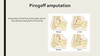 Amputation dr. harsh | PPT