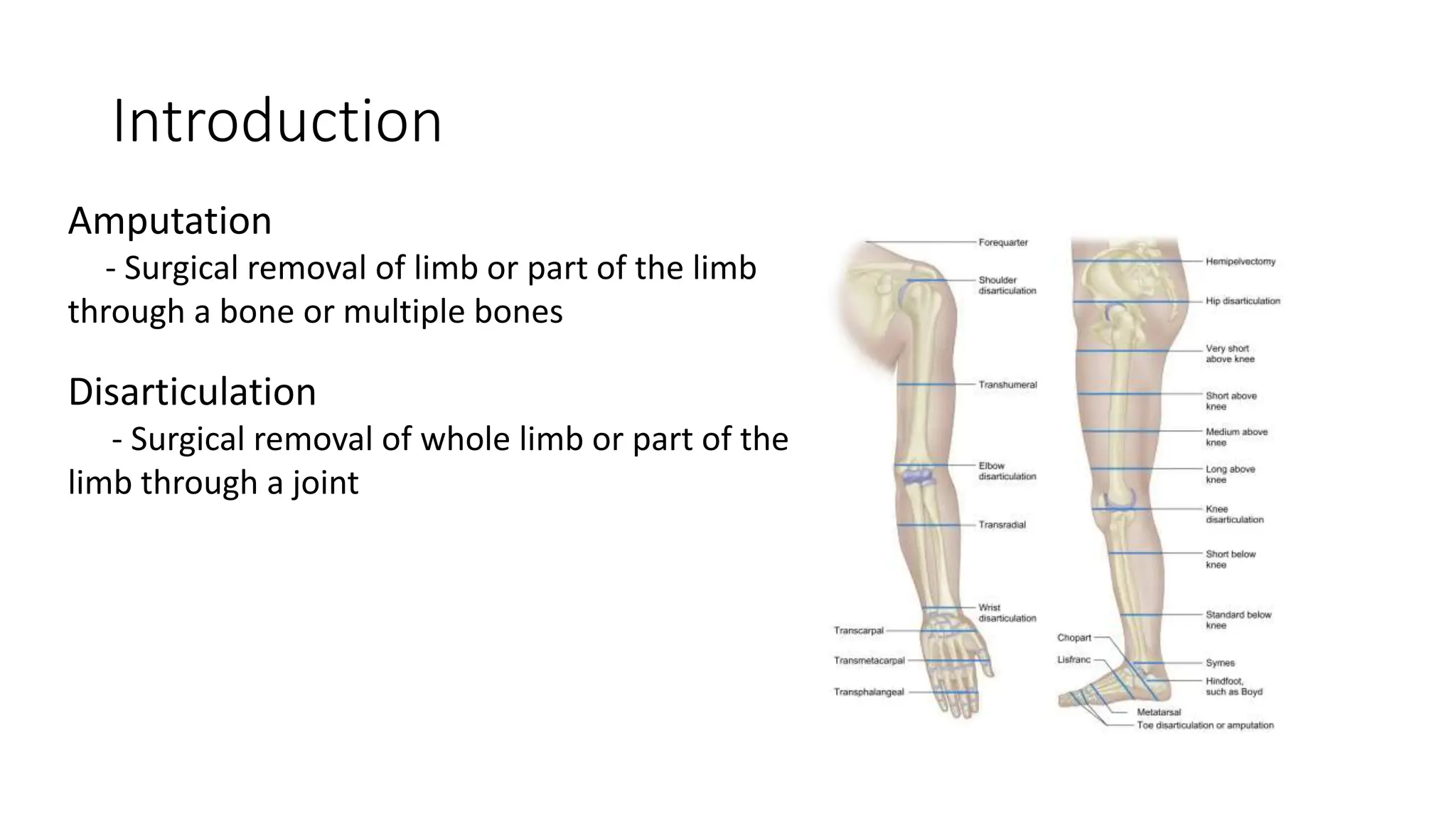 Amputation-Dr.Kushal Khanal 2nd Year .pptx