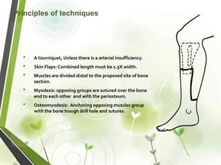 amputation orthopedics mbbs with types.pptx