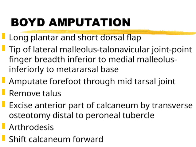 Amputation1.ppt in crush injury of upper and lower | PPT