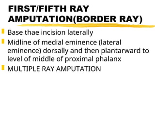 Amputation1.ppt in crush injury of upper and lower | PPT