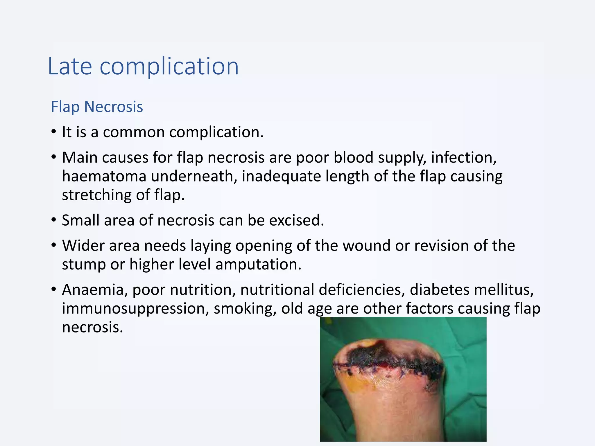 Amputation and disarticulation | PPTX