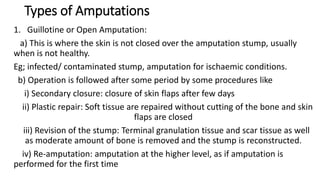 Amputation and Prosthesis | PPTX