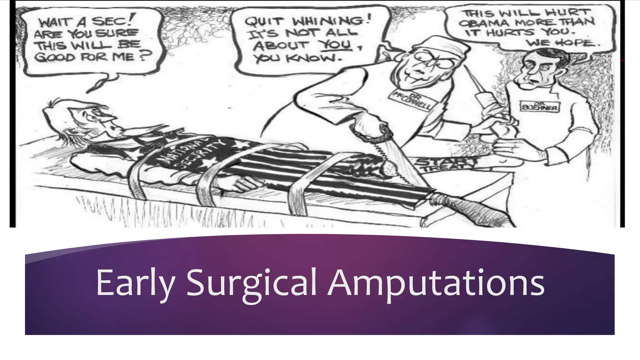 Amputation and prosthesis | PPTX