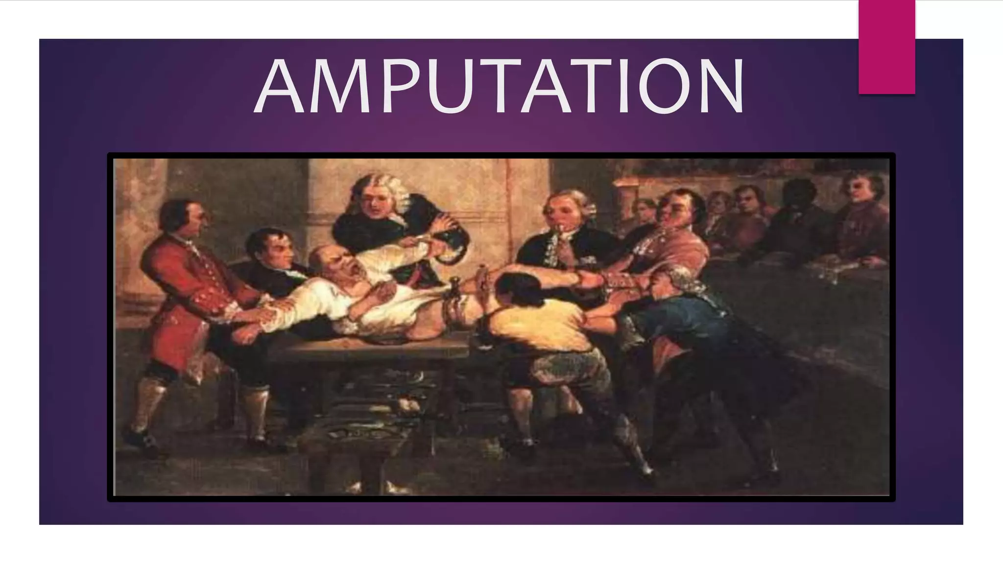 Amputation and prosthesis | PPTX