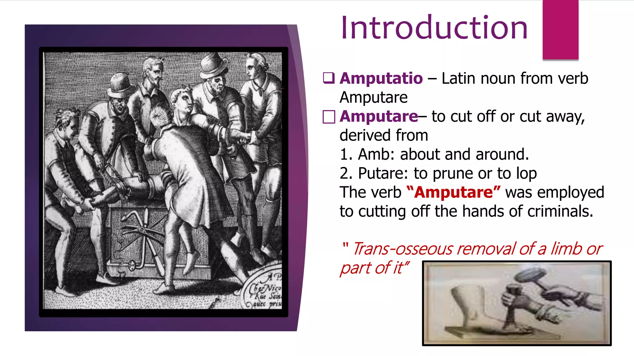 Amputation and prosthesis | PPTX