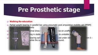 Amputation and prosthesis | PPTX