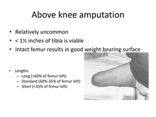 Amputation and rehabilitation | PPT