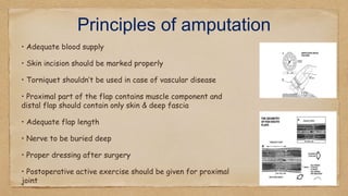 Amputation | PPTX