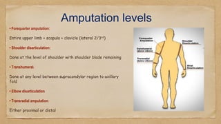 Amputation | PPTX