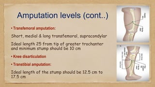 Amputation | PPTX