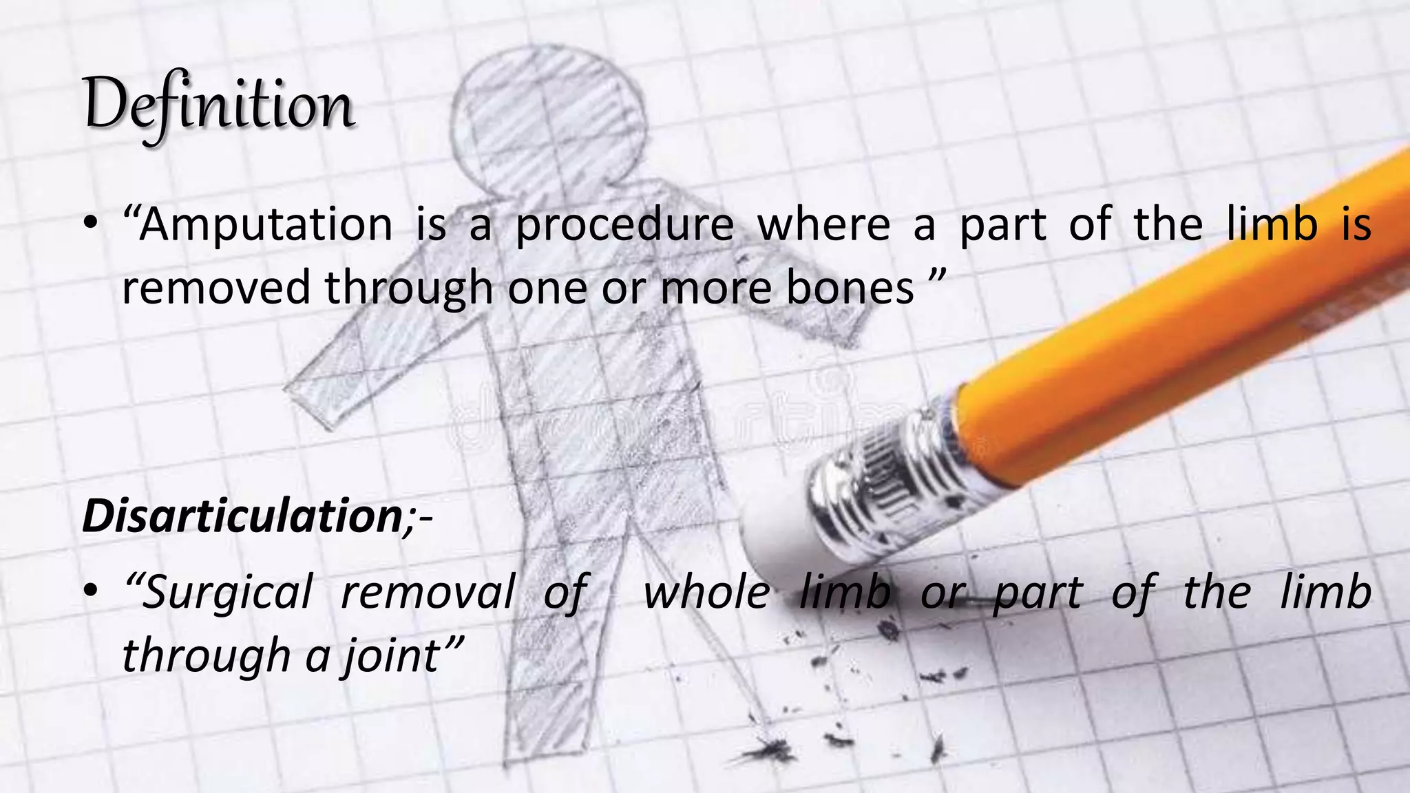 amputation final ppt.pptx