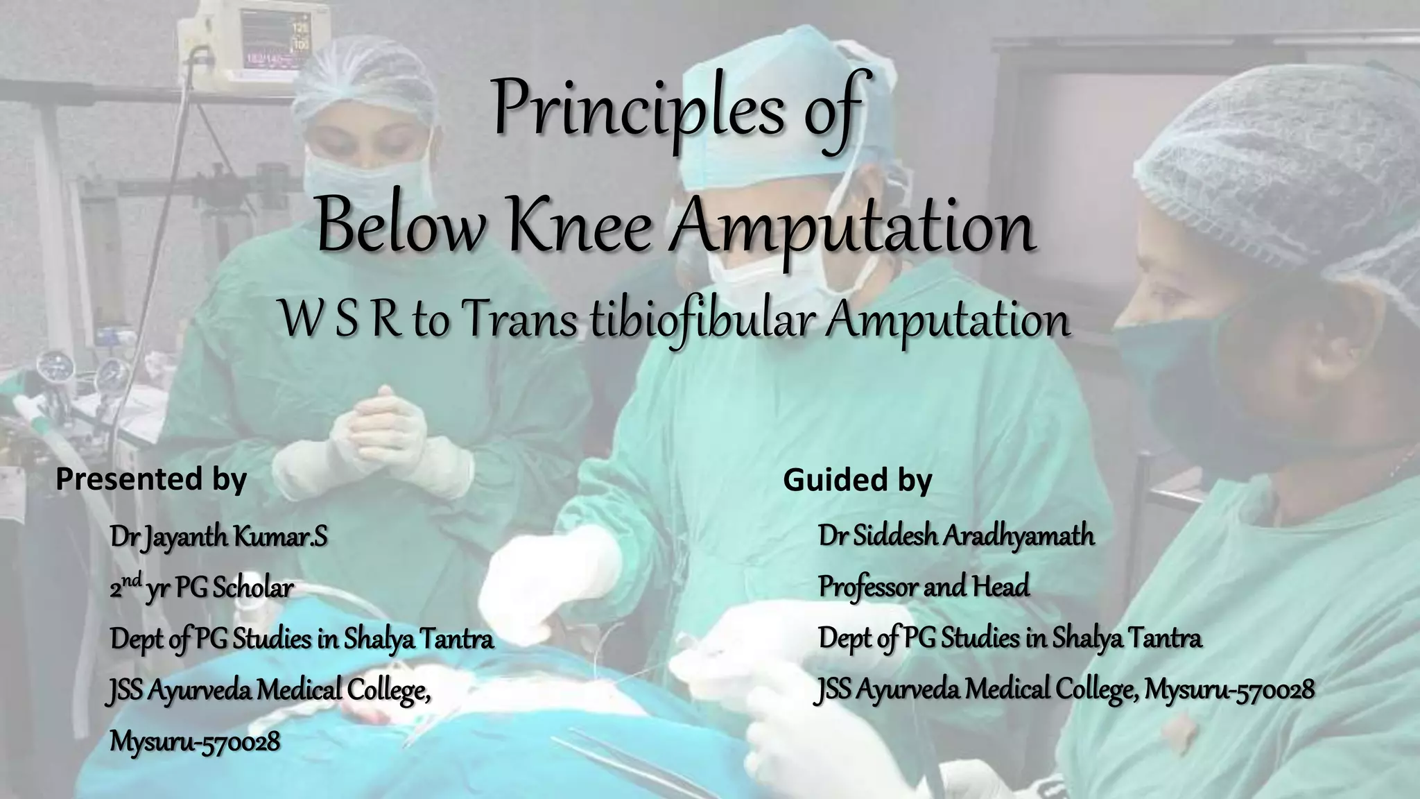 amputation final ppt.pptx