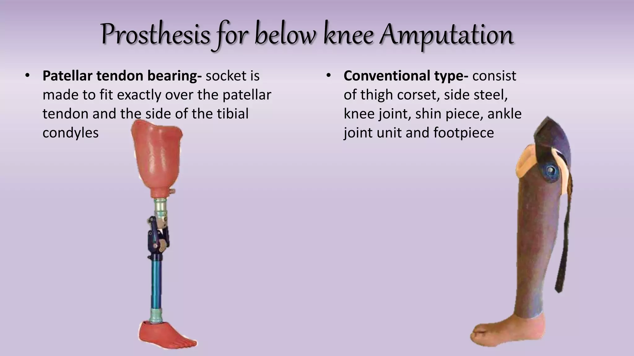 amputation final ppt.pptx