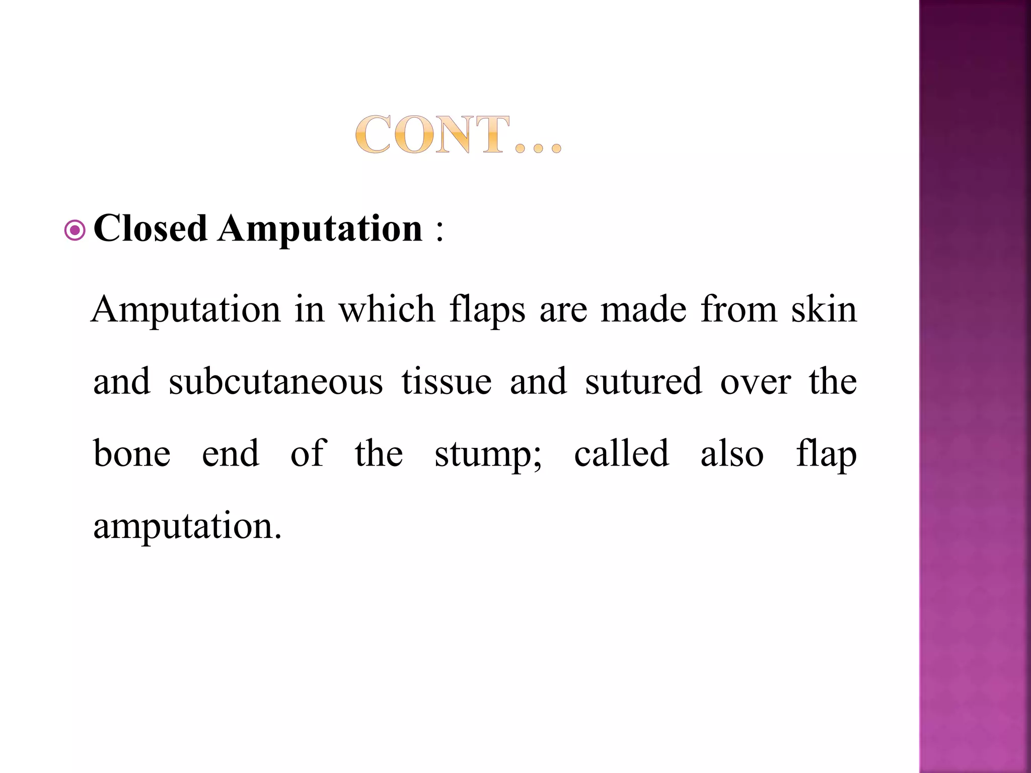 amputation final ppt (1).pptx