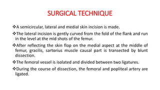 Amputation of hindlimb | PPTX