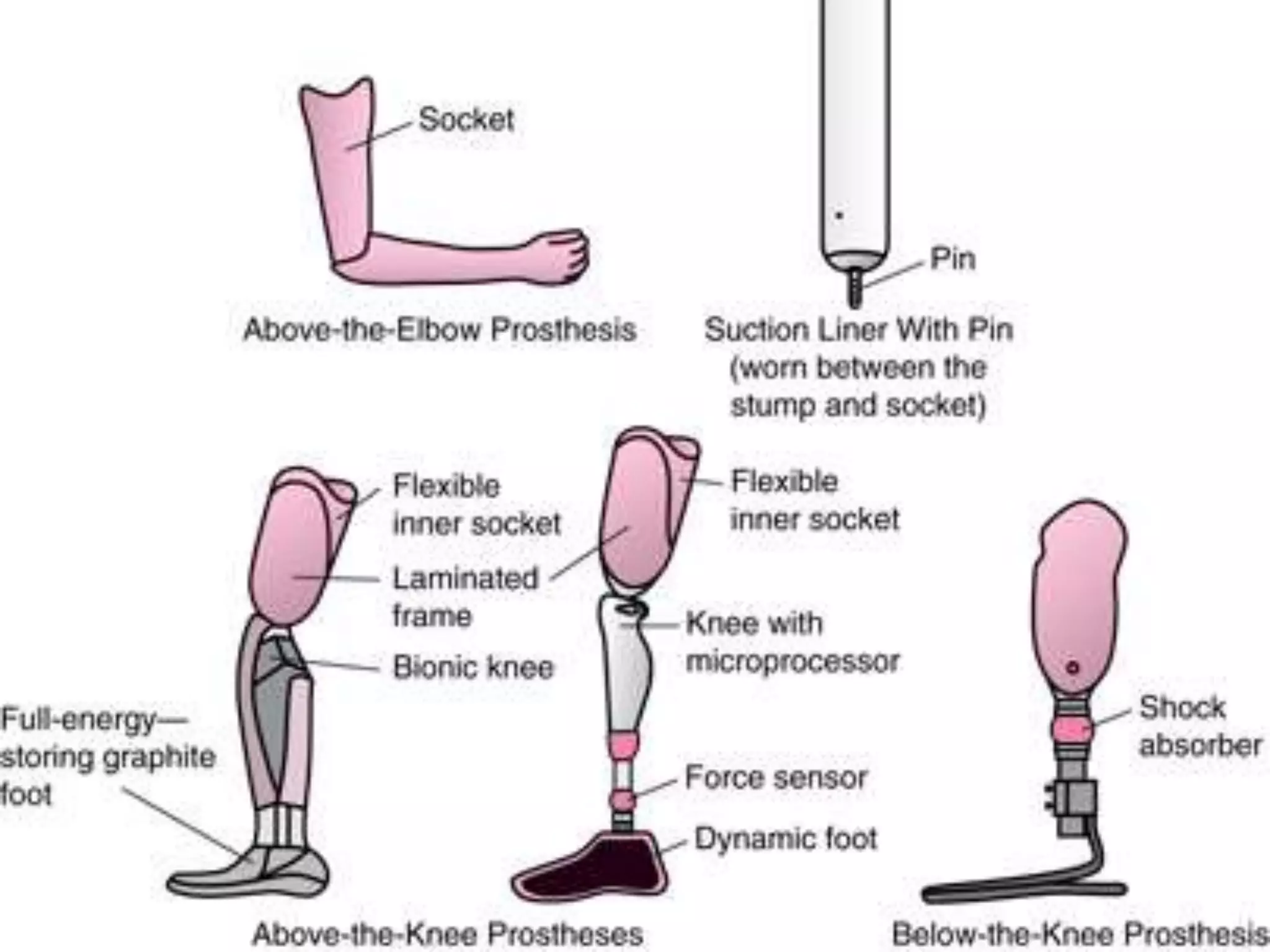 Amputation & prosthsis... | PPTX | Death, Injury, or Military Conflict ...