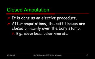 Amputations | PPTX