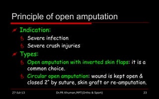 Amputations | PPTX
