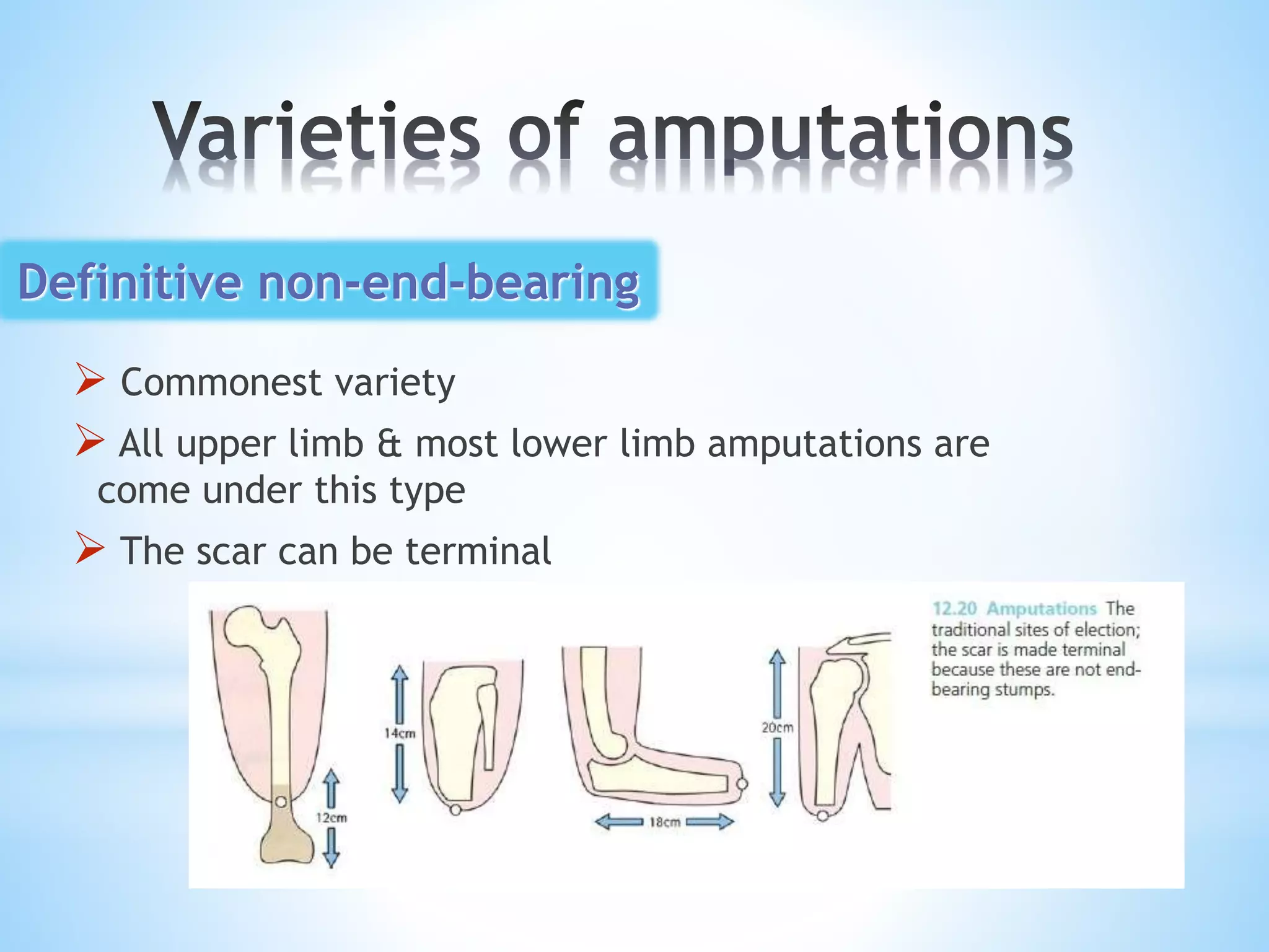 Amputations of extremity | PPTX | Injuries | Diseases and Conditions
