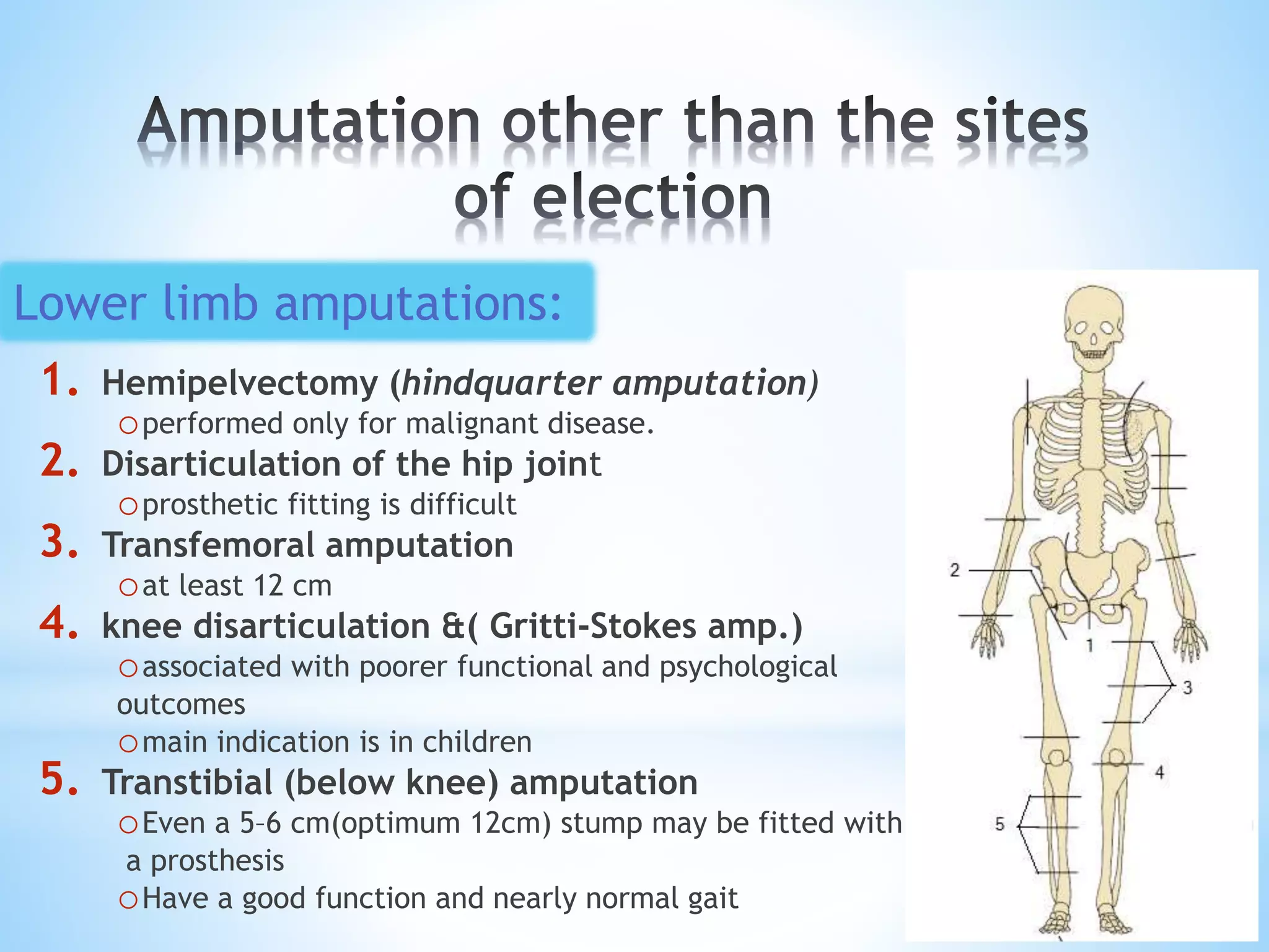 Amputations of extremity | PPTX