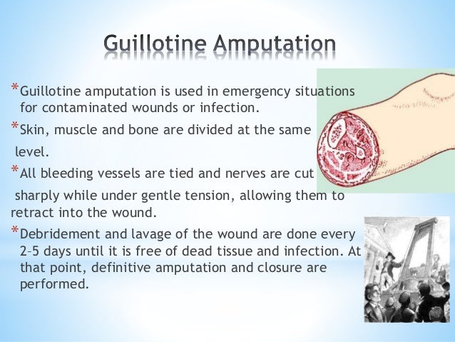 Amputations of extremity