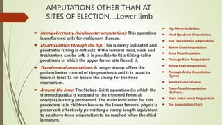 AMPUTATIONS.pptx