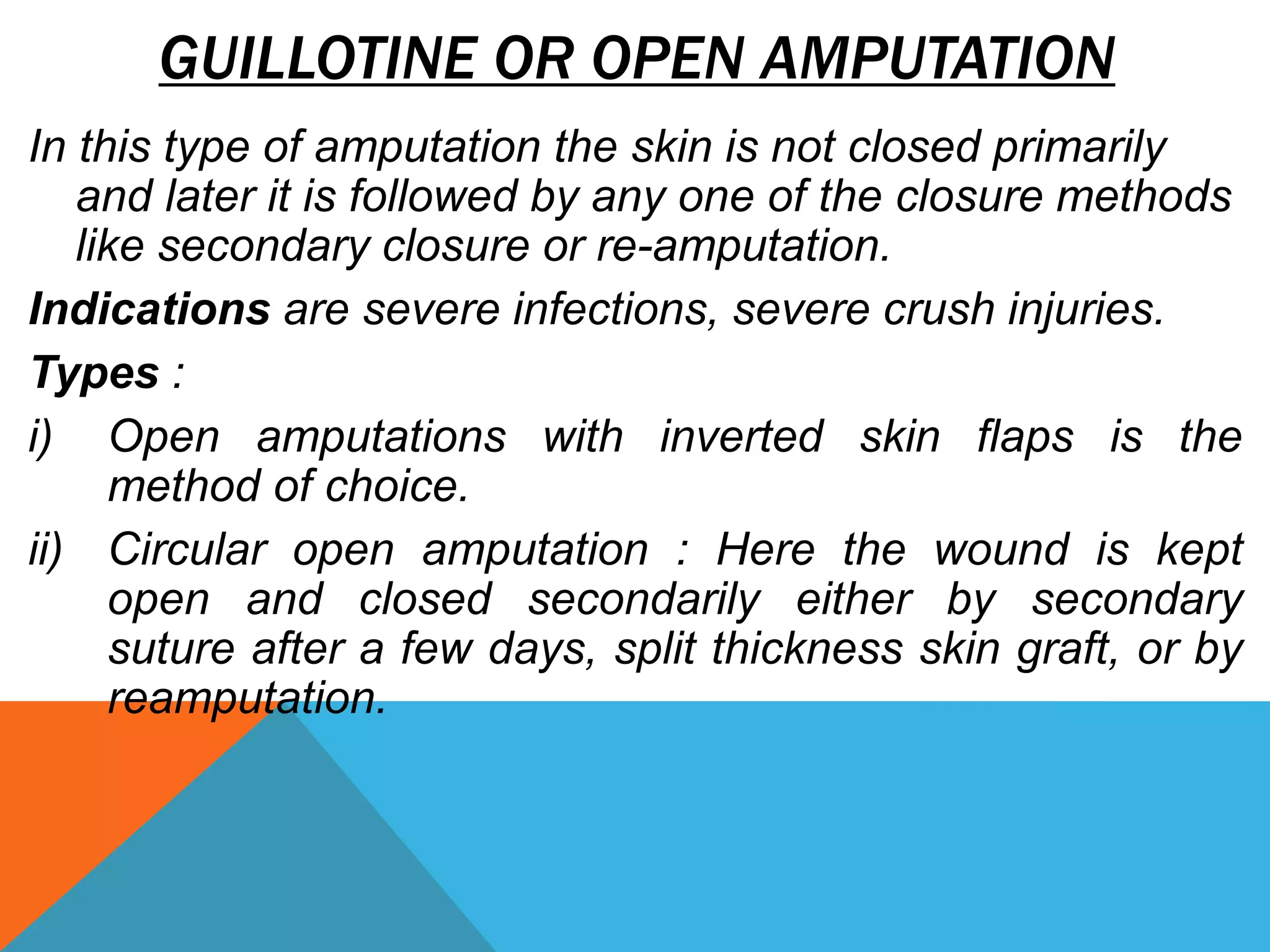 amputations.pptx