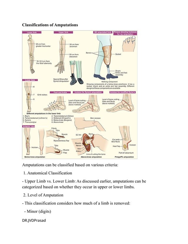 AMPUTATIONS- Definition, Types, procedures, indications | DOCX ...