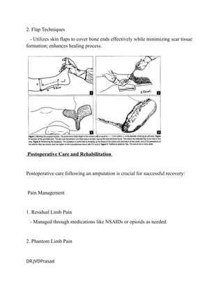 AMPUTATIONS- Definition, Types, procedures, indications | DOCX