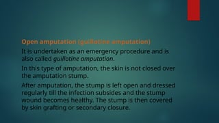 Amputations Types and management and Physiotherapy | PPTX