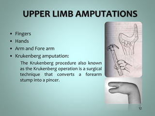 AMPUTATIONS-PRESENTATION.pptx