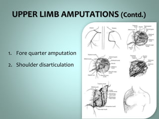 AMPUTATIONS-PRESENTATION.pptx